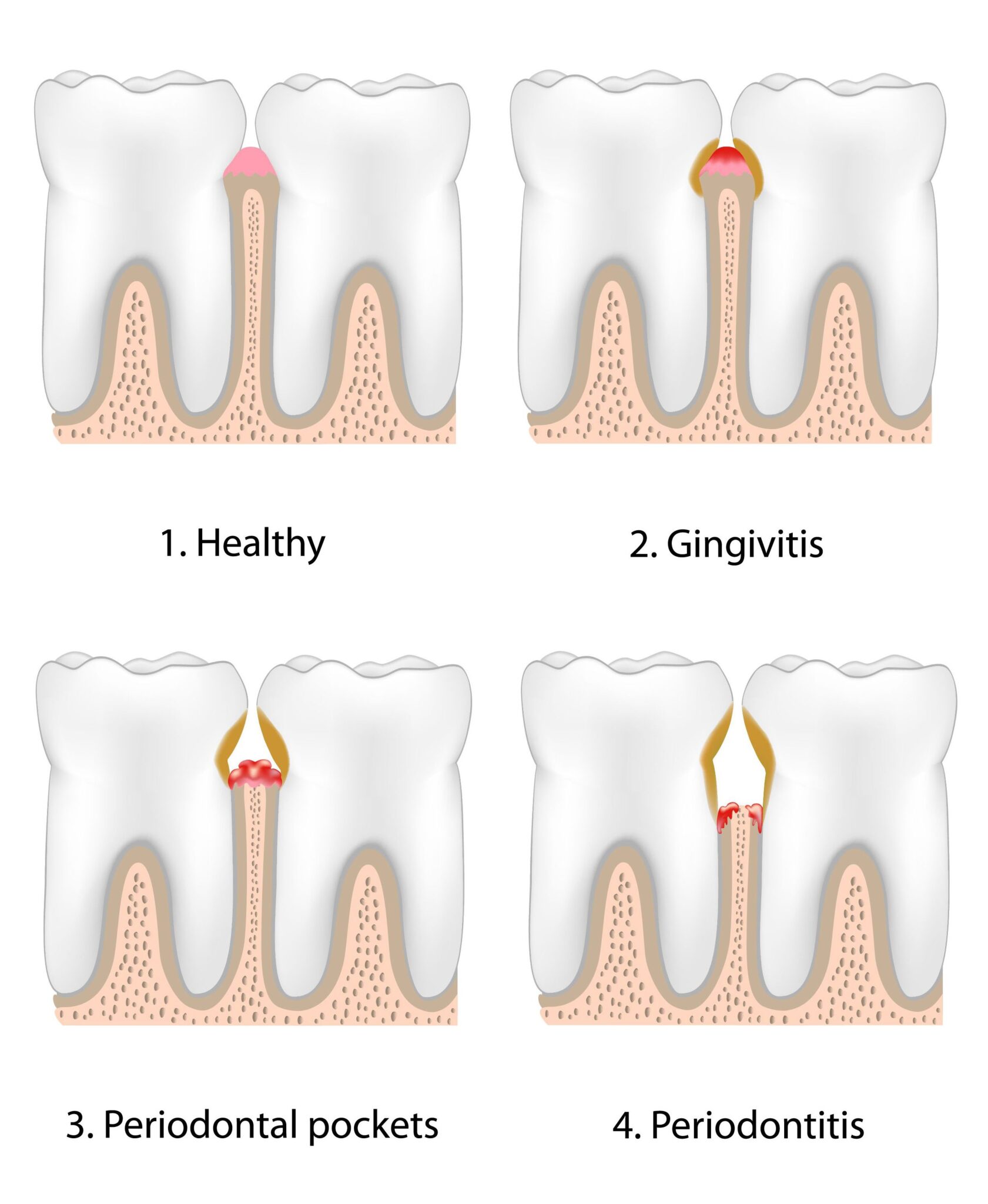What Your Gums Are Telling You About Your Overall Health – Frederick ...